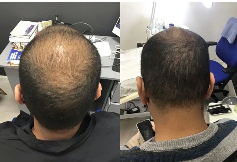 Este Hair Medical – Non-Surgical Hair Restoration & Skin Care Treatments